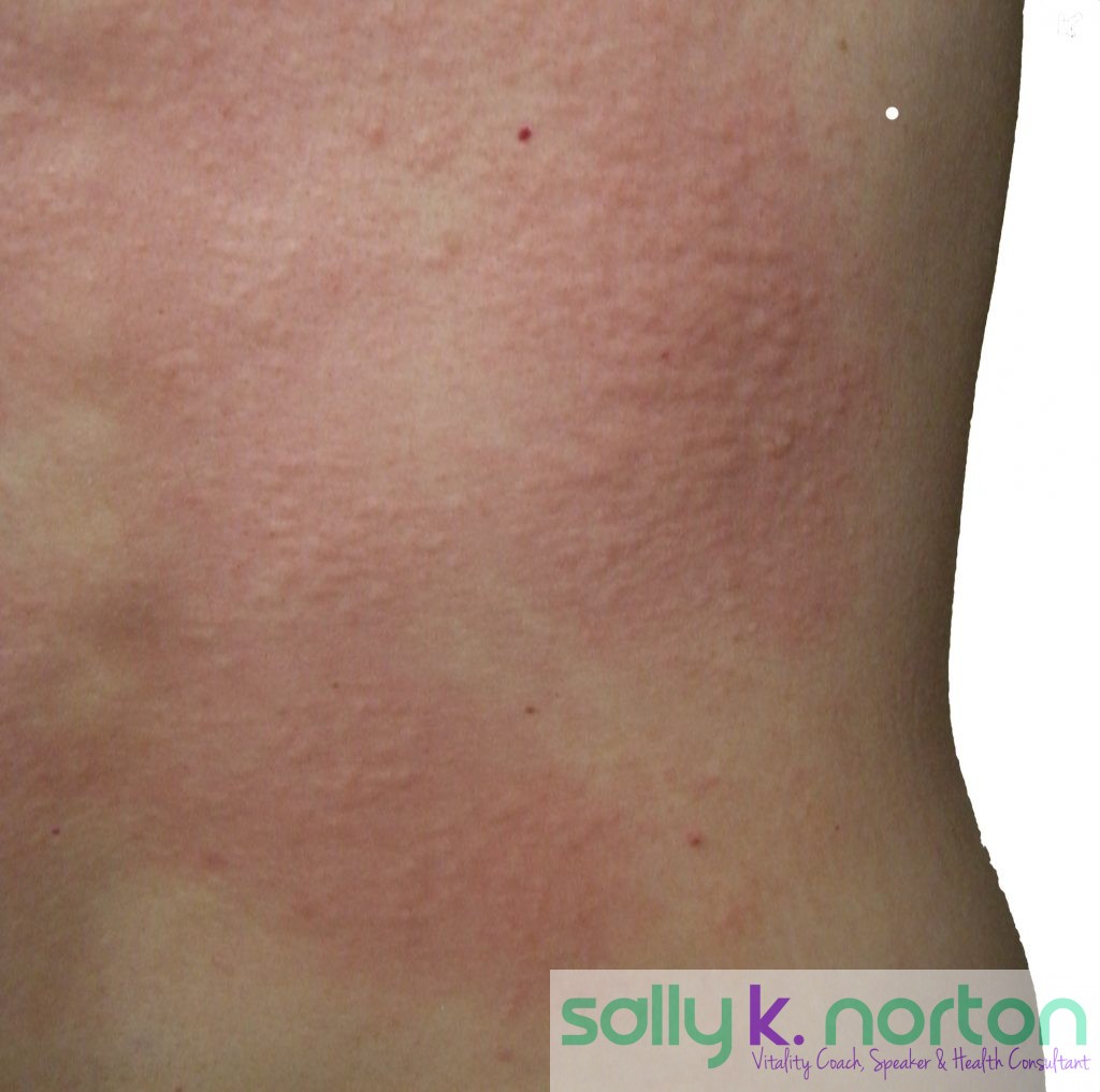 Joint pain? Inflammation? Slow to heal? Fatigue? Sleep issues? - Sally ...